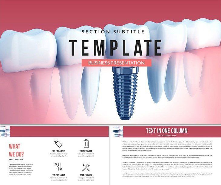 Dental Implant Cost PowerPoint template